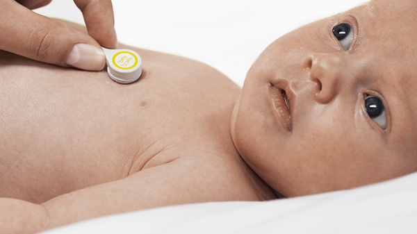Transcutaneous monitoring - transcutaneous monitors - Radiometer