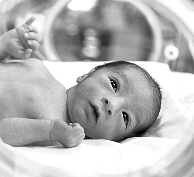 Radiometer introduces MicroMode measuring for fetal scalp and neonatal ...